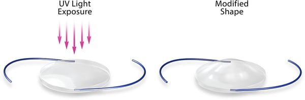 New Cataract Lens Technology